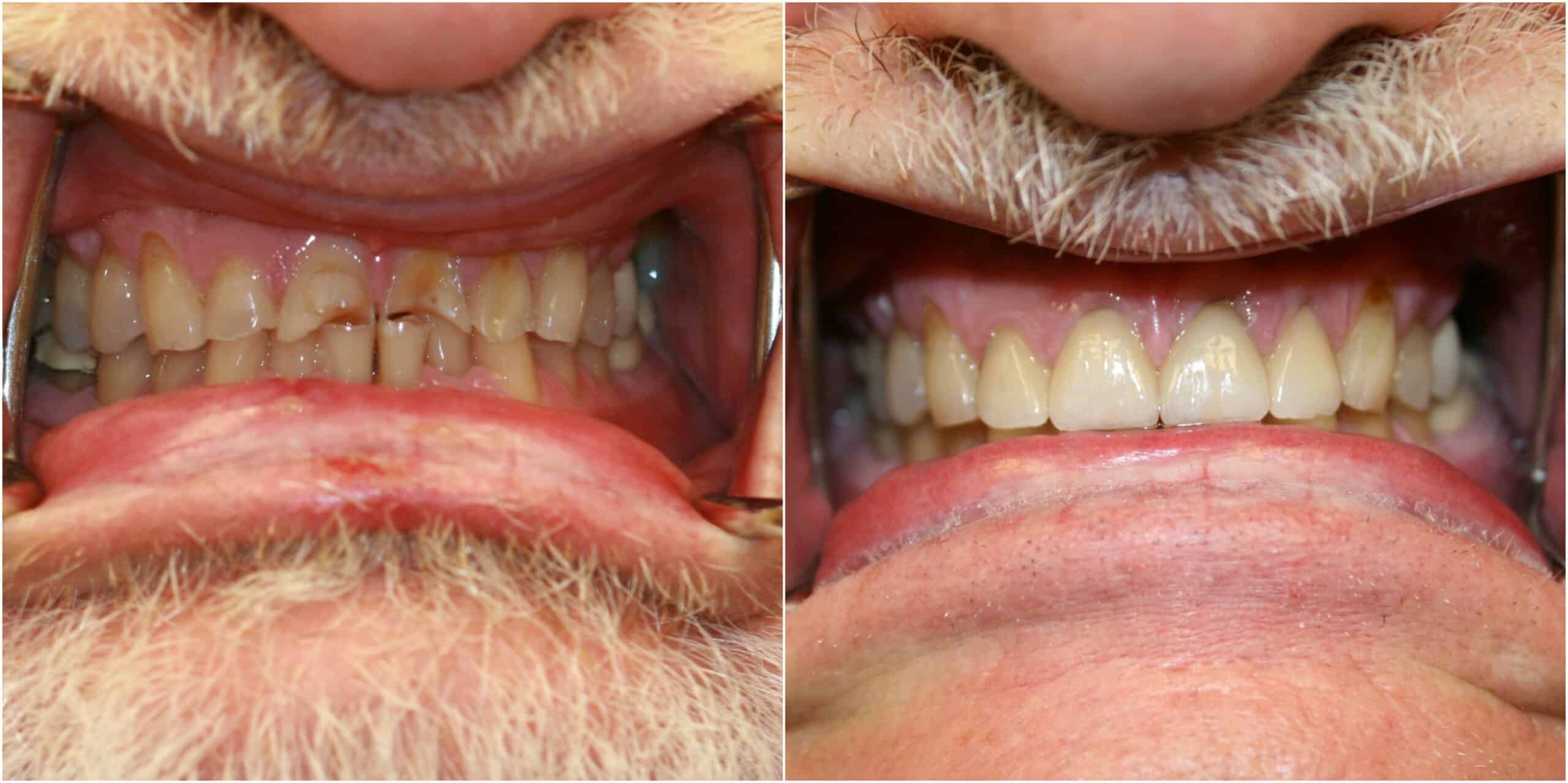 Idaho Falls Family Dentist Ammon ID Zirker Family Dentist